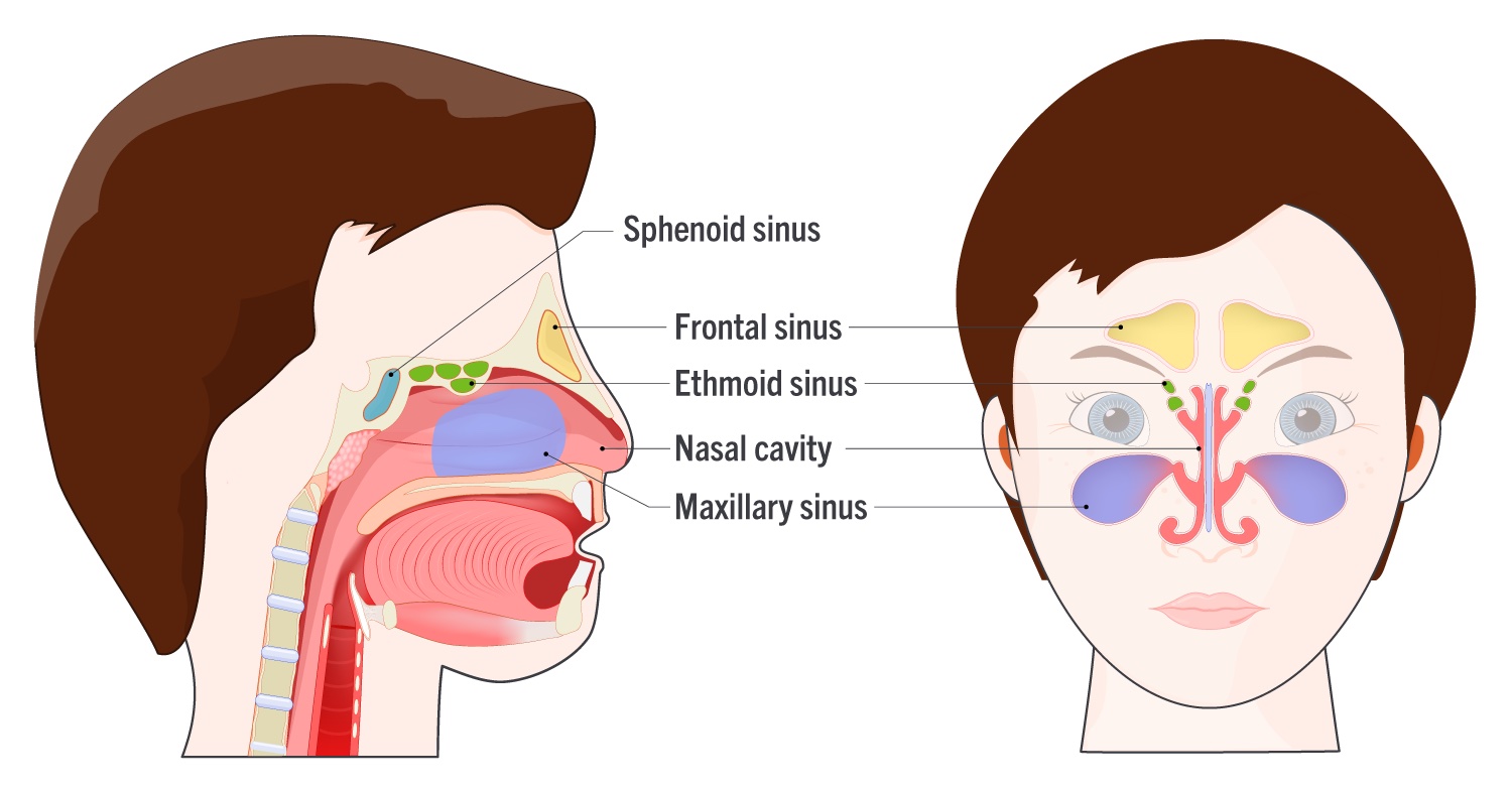 Frontal Sinus Headache Frontal Sinus Headache